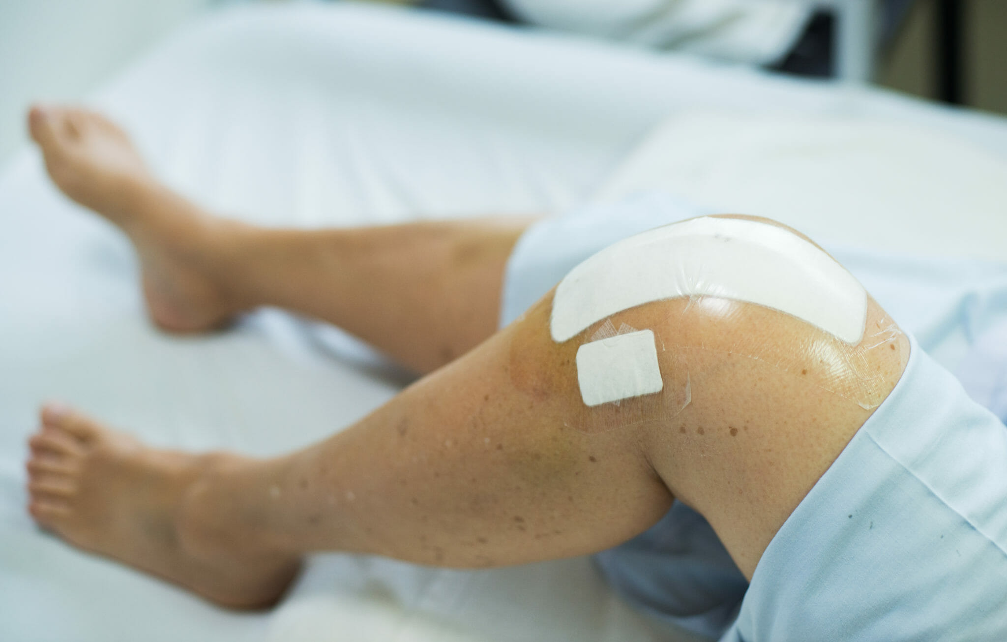 Knee Replacement Surgery - Total Knee Replacement - Horder Healthcare